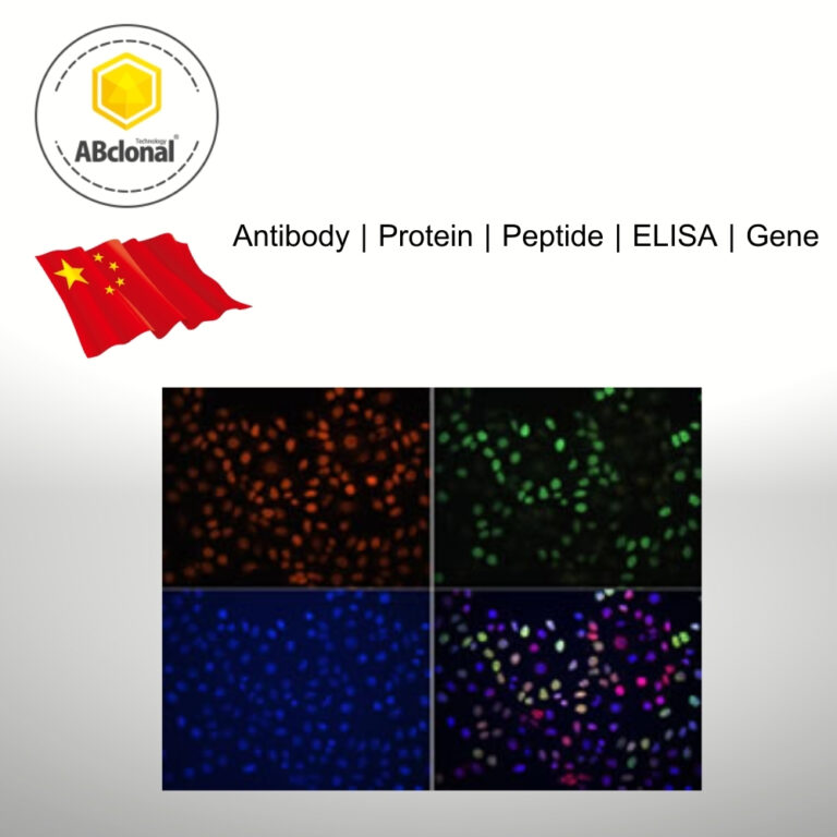 Antibodies, ABclonal, China - BioEntist Co., Ltd.